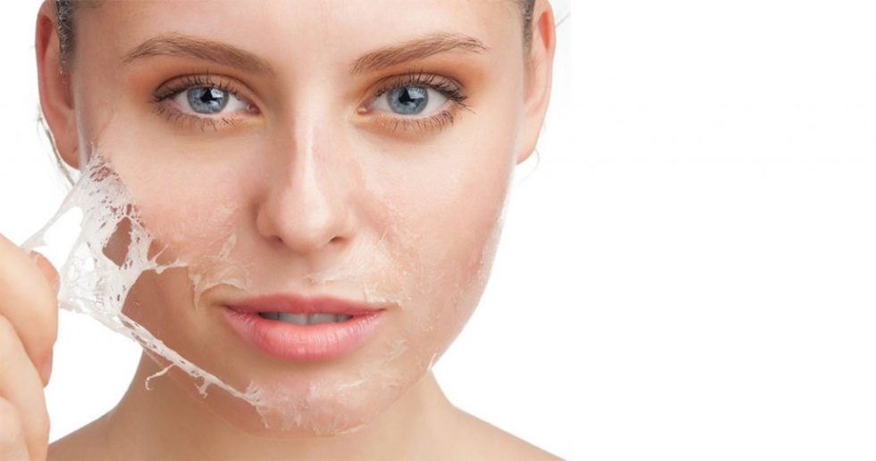 Peeling phenol, le peeling profond aux résultats spectaculaires